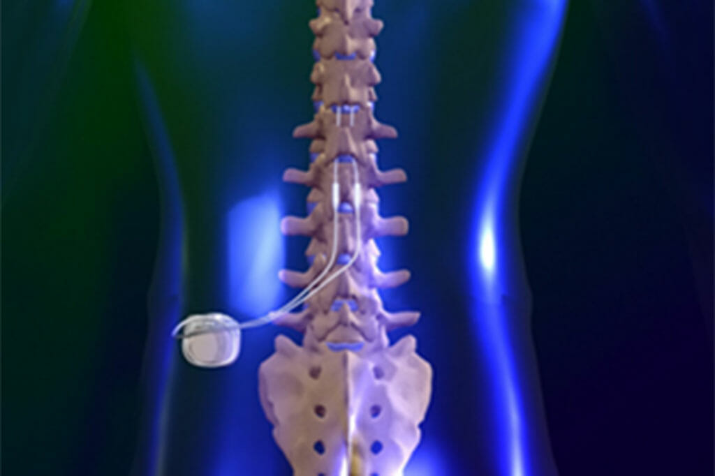 Implantable Medical Devices - NEOTech